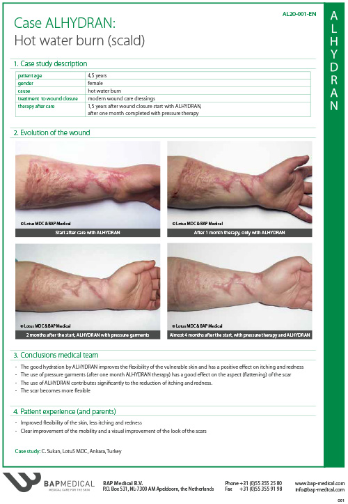 Case Studies - Alhydran.com