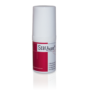 Scarban medical silicone sheets en gel - Scarban Scar Treatment